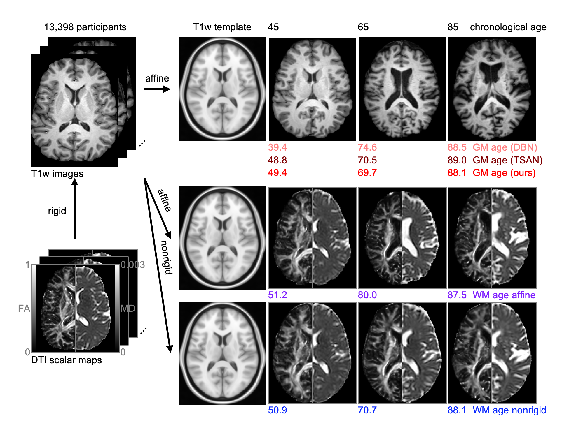 BRAID: Brain Age Identification from Diffusion MRI | Chenyu Gao